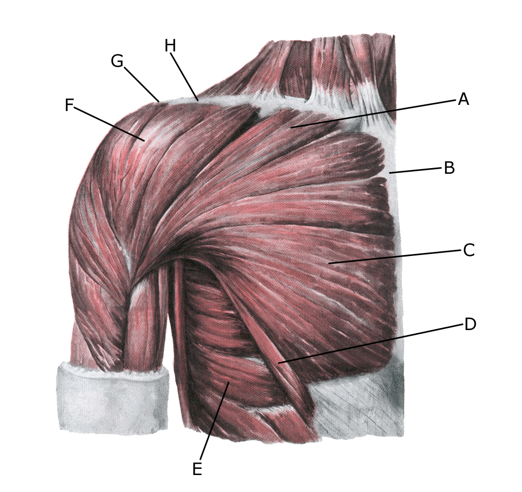 Rupture of the large chest muscle - Sportnetdoc